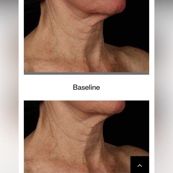 SkinMedica | Skincare | Neck Correct Cream | Poshmark